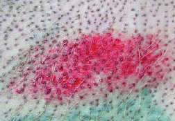 Zoetis